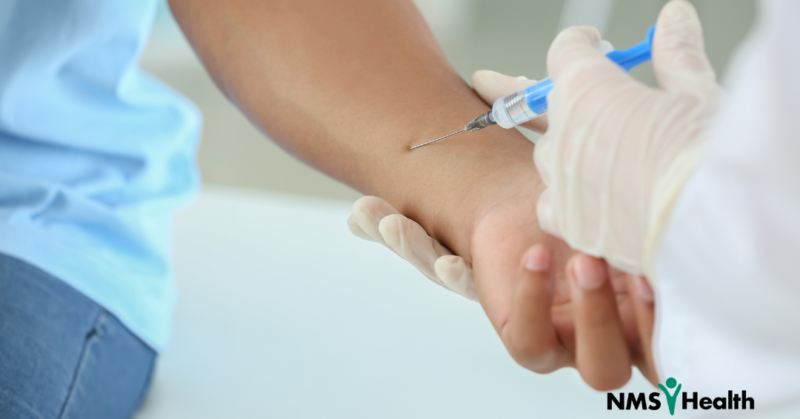 The National PPD Skin Test Shortage: What's Causing it and How to Get ...