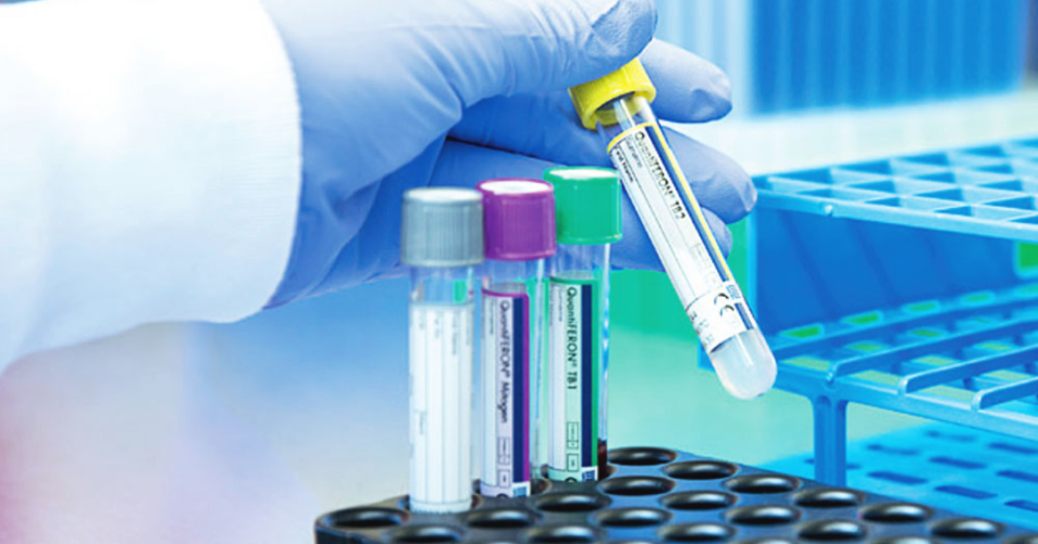 QuantiFERON Gold vs T-SPOT: IGRA TB Testing - NMS Health