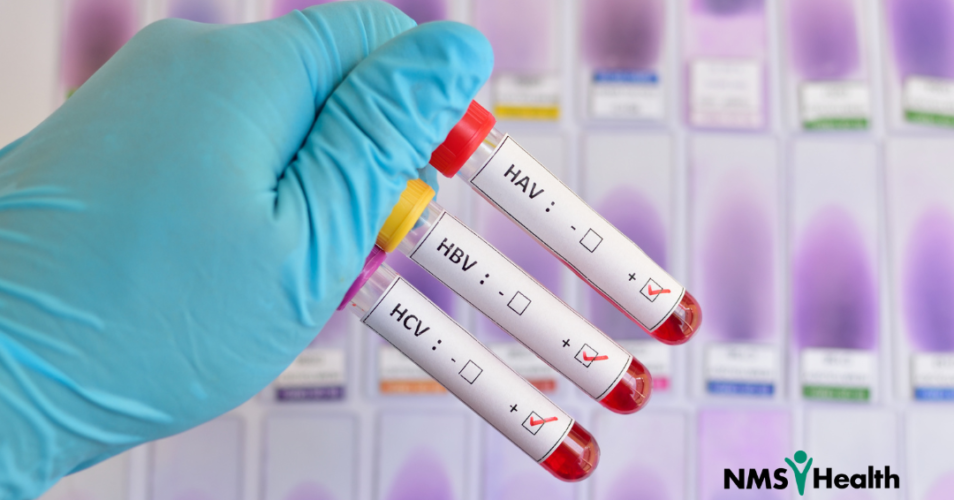 Why You Should Titer Test Your Employees - NMS Health