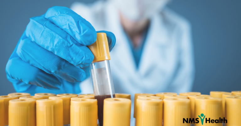 What is a Titer Test? - Titer Testing Your Employees - NMS Health