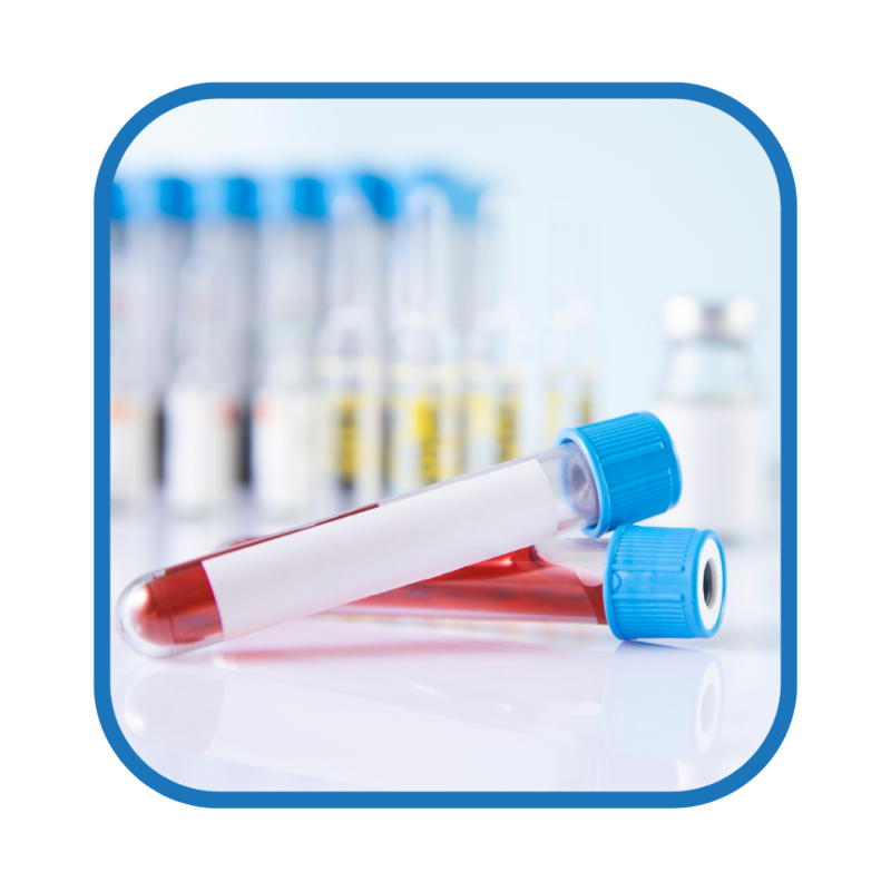Hepatitis A Antibody Titer - NMS Health